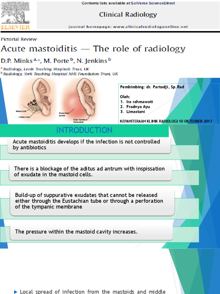 Acute Mastoiditis and Intracranial Complications | PDF | Meningitis | Magnetic Resonance Imaging