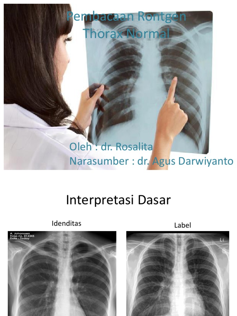 Pembacaan Rontgen | PDF