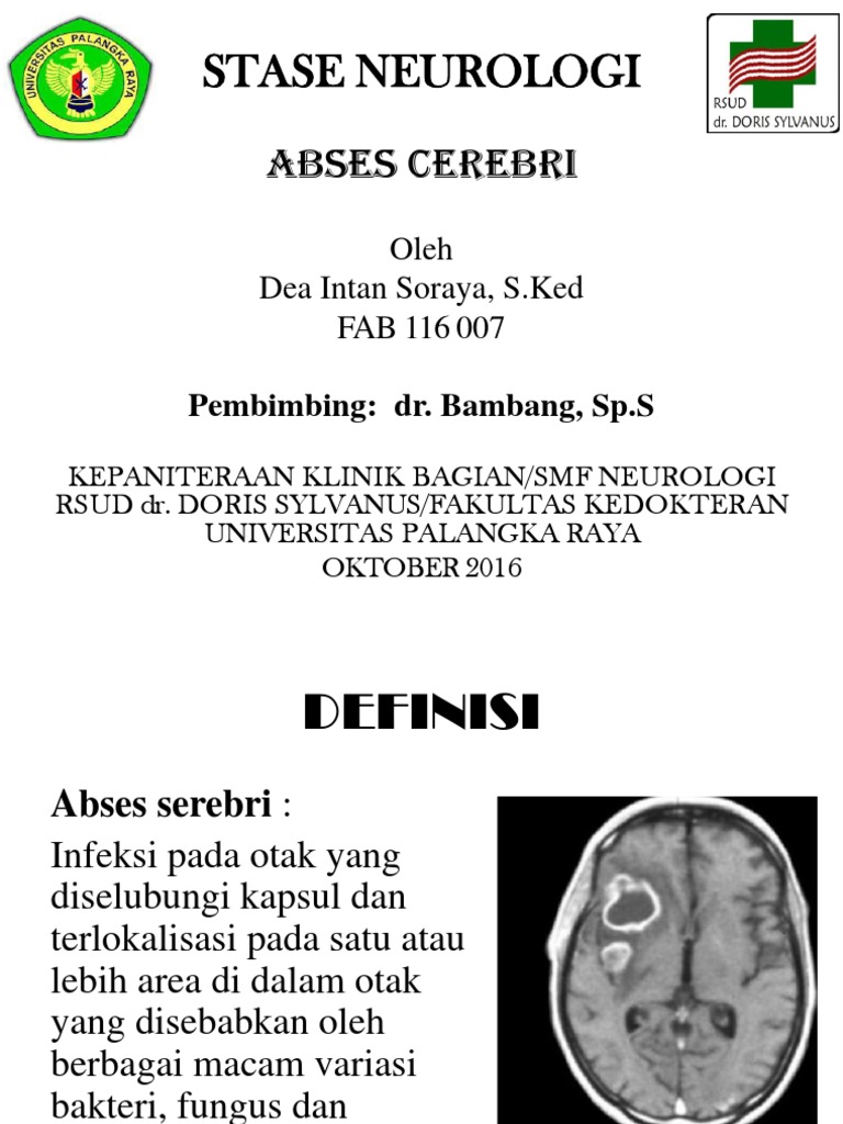Abses Cerebri | PDF
