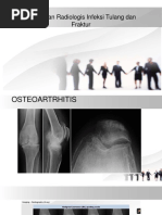 Imaging of The Ear - X Ray of The Temporal Bone, Schuller's Projection ...