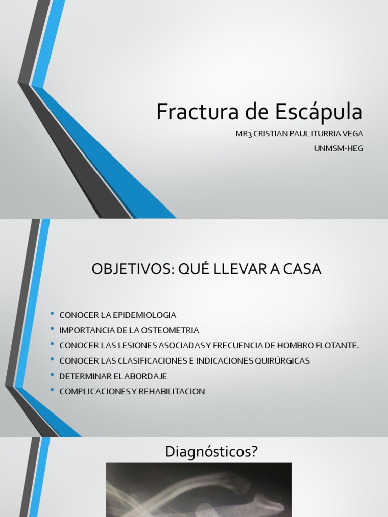 Clasificación y Tratamiento de Fracturas de Escápula | PDF | Hombro ...