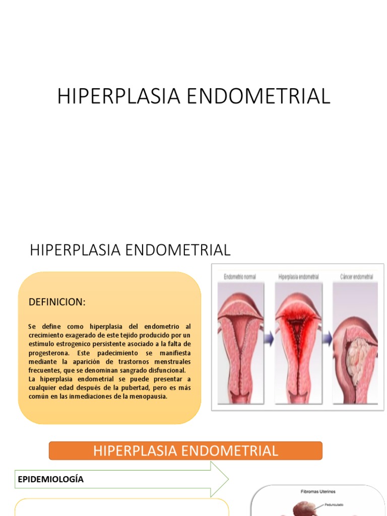 Hiperplasia Endometrial: Definición y Tratamiento | PDF | Menopausia ...