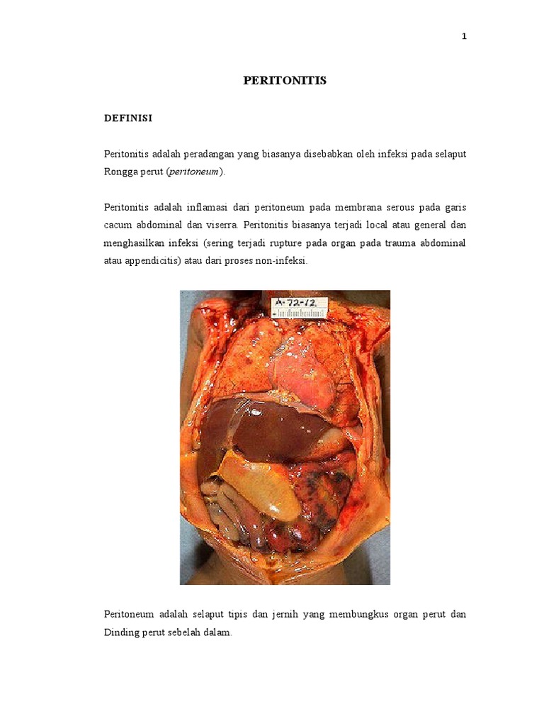 Peritonitis | PDF