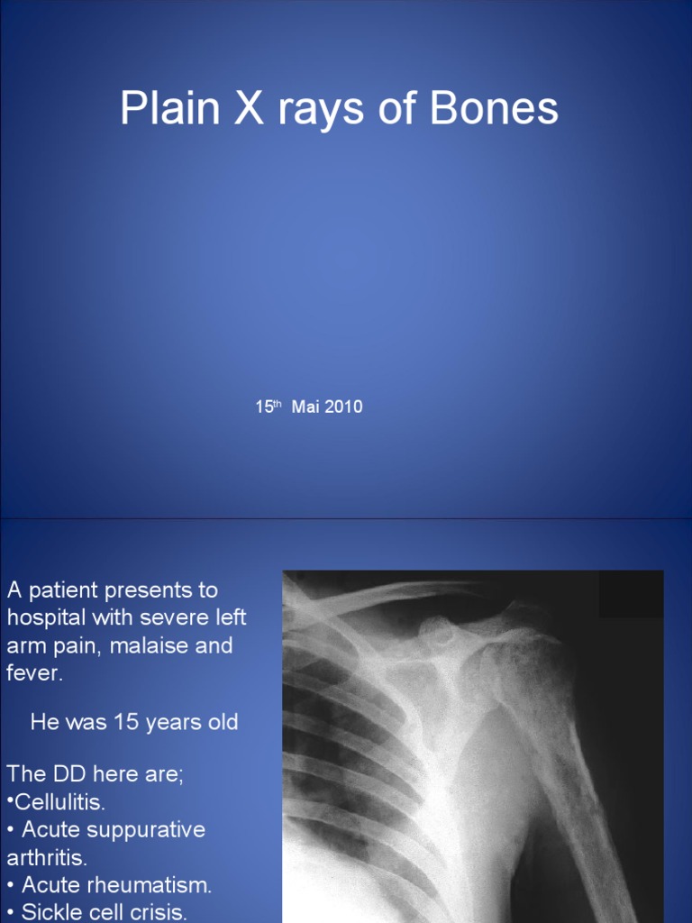 Plain X Rays of Bones | PDF | Clinical Medicine | Diseases And Disorders