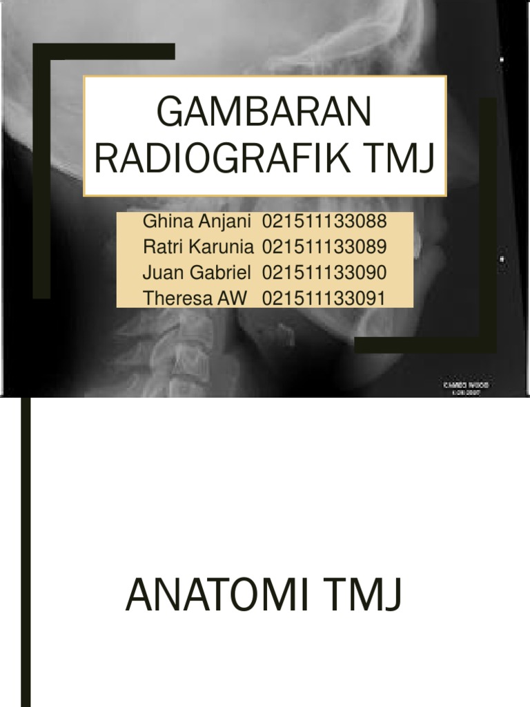 b9 - Gambaran Radiografik TMJ | PDF | Sains & Matematika