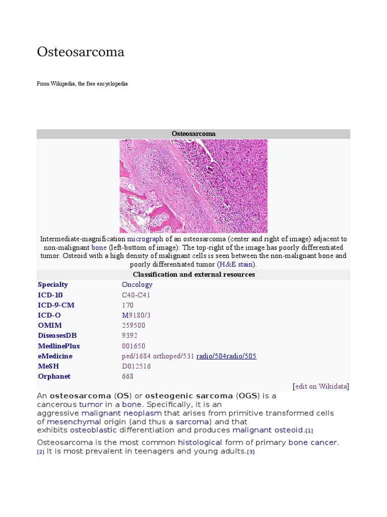 Osteosarcoma: Micrograph Bone H&E Stain Oncology | PDF | Cancer | Medicine