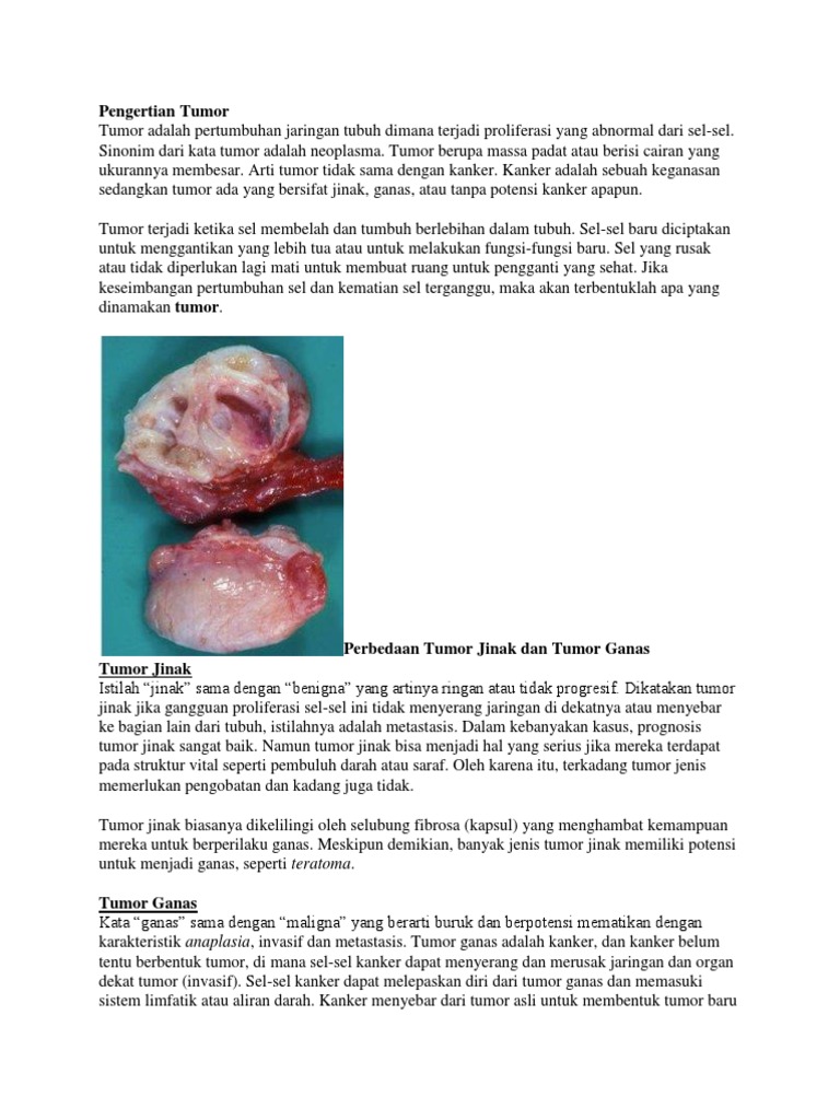 Pengertian Tumor | PDF