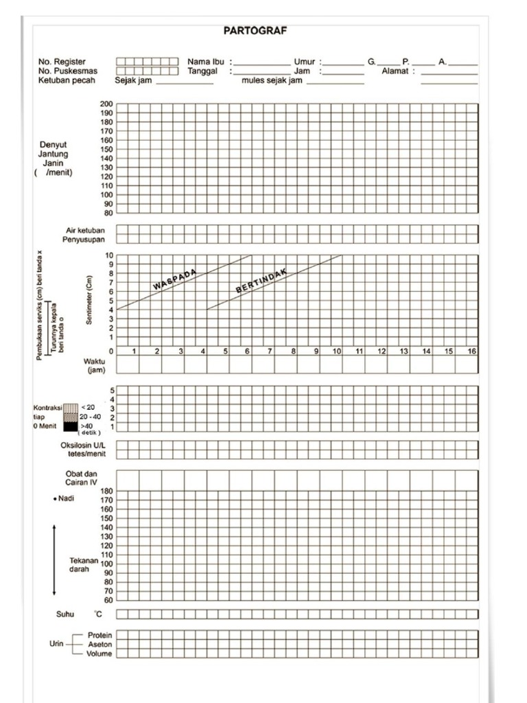 Contoh Partograf | PDF