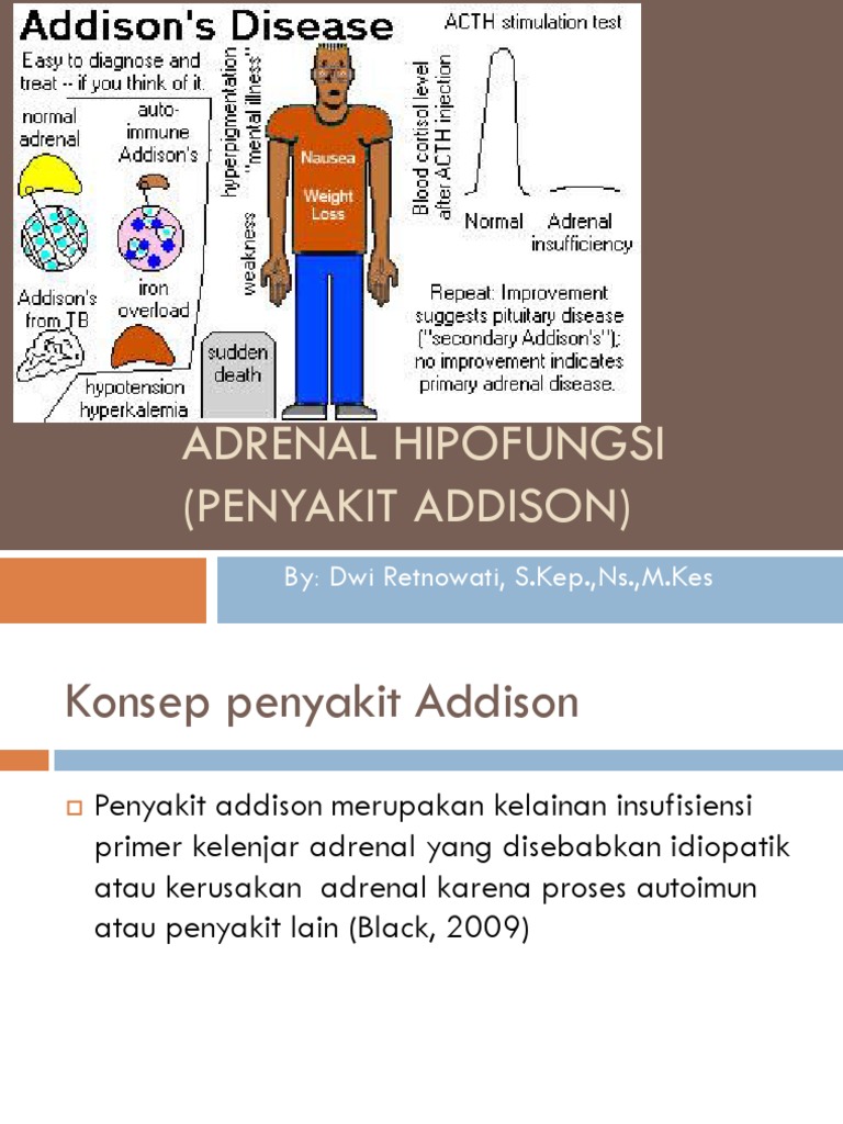 Adrenal Hipofungsi (Penyakit Addison) | PDF