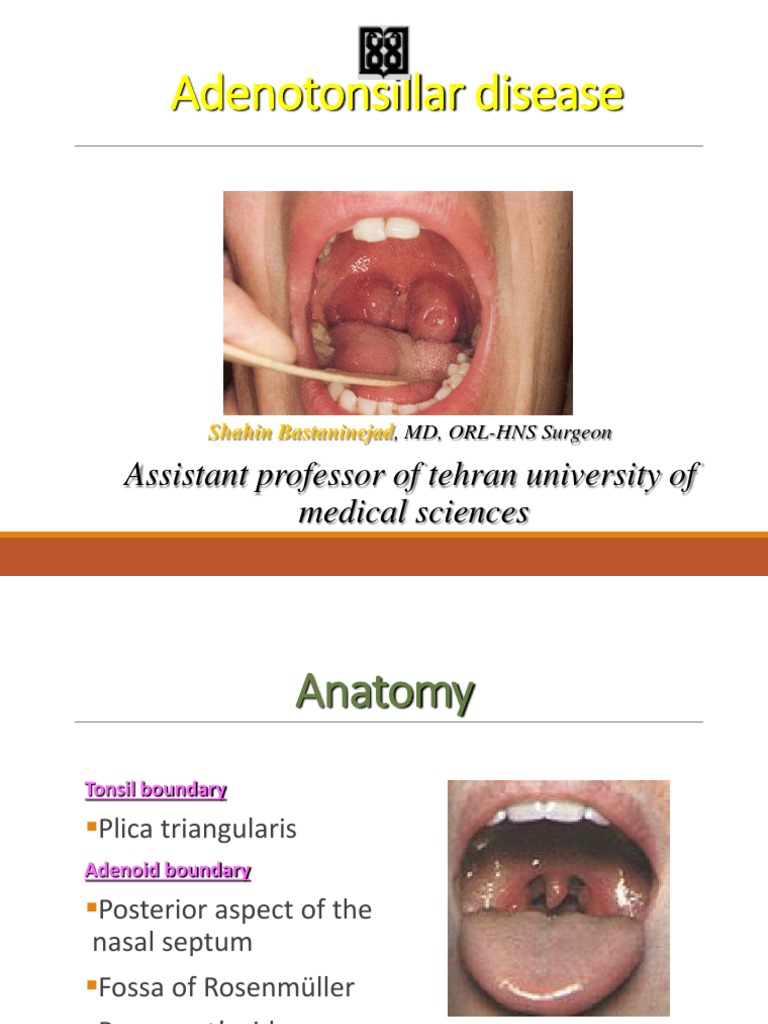 Adenotonsillar Disease Bastaninejad | Download Free PDF | Infection ...