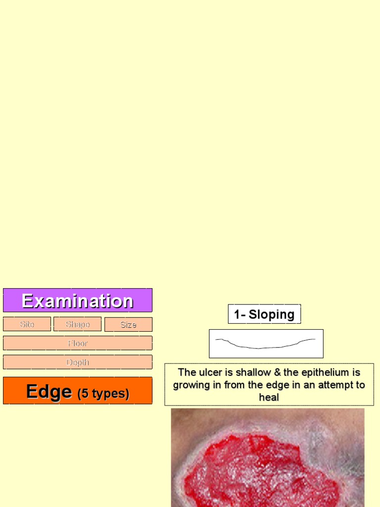How To Examine Ulcers Part2 | PDF | Anatomy | Integumentary System