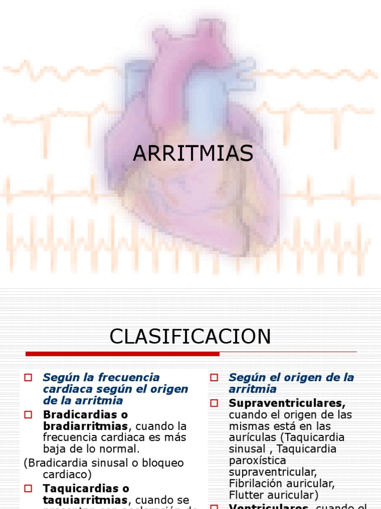 arritmias-130915202546-phpapp02 | Fisiología Cardiovascular | Sistema ...