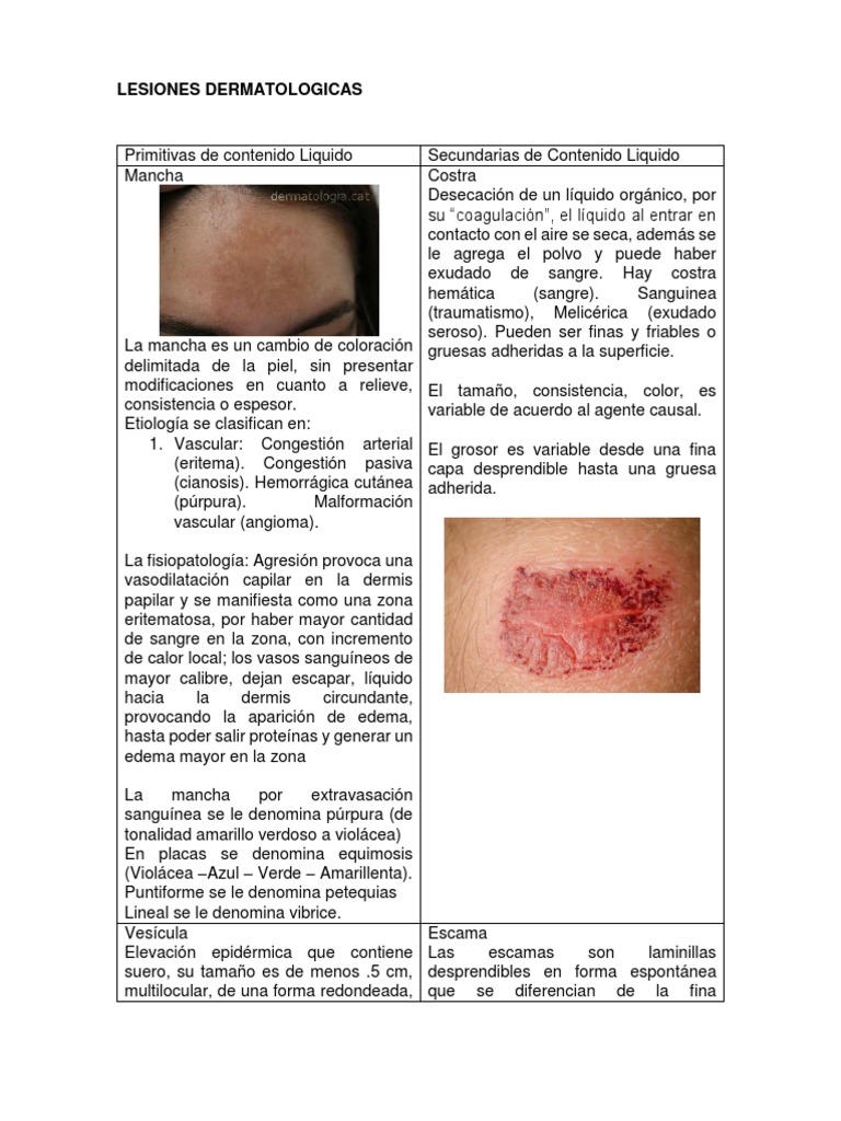 Lesiones Dermatologicas | PDF | Piel | Epidermis
