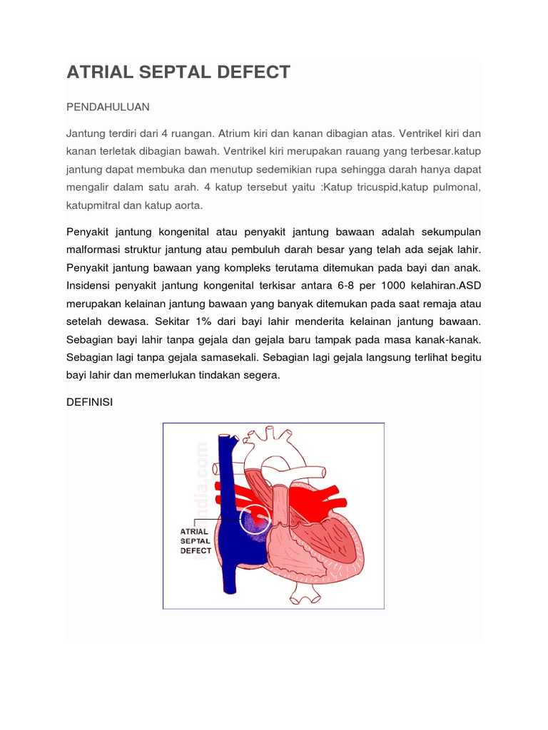 Asd Secundum | PDF