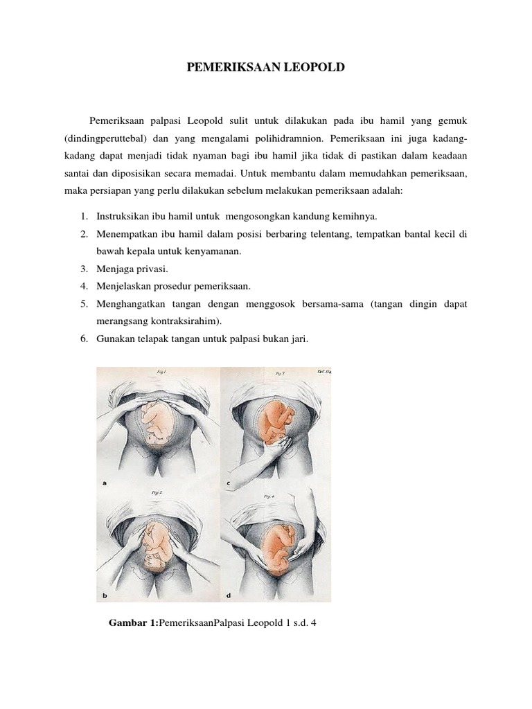 Pemeriksaan Leopold | PDF