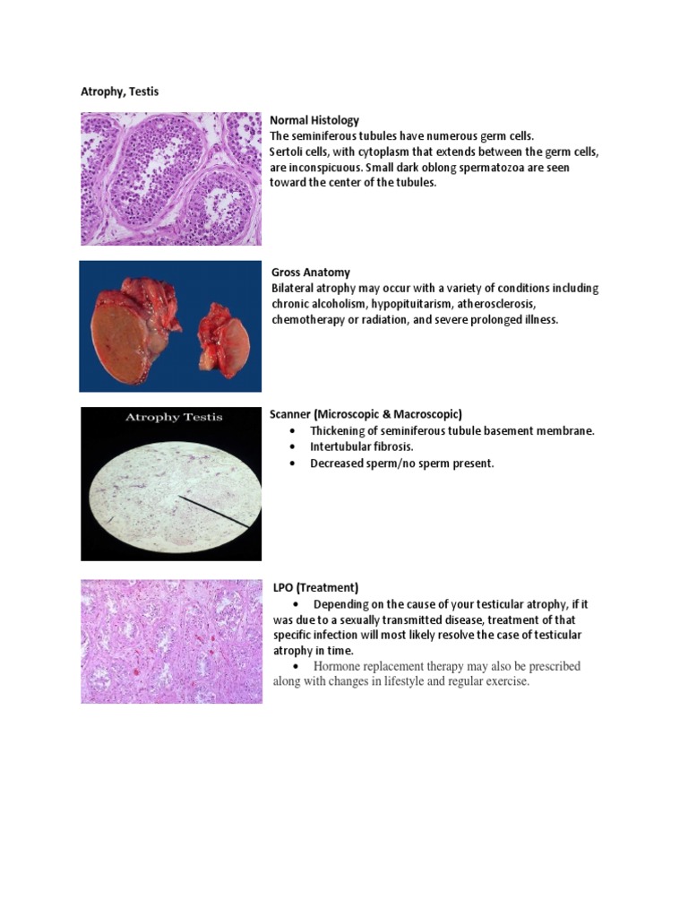 Atrophy, Testis Normal Histology | PDF | Heart | Testicle