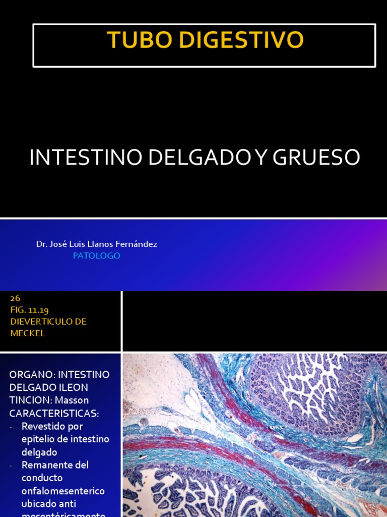 Micro Medicina y Remanente Onfalomesentérico | PDF | Anatomía