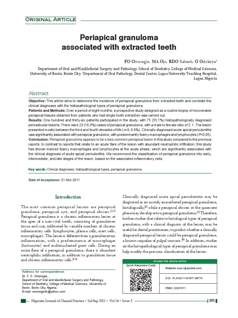 Periapical Granuloma Associated With Extracted Teeth: Original Article ...