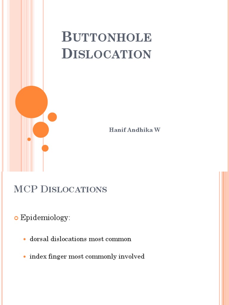 Buttonhole Dislocation | PDF | Joints | Musculoskeletal System