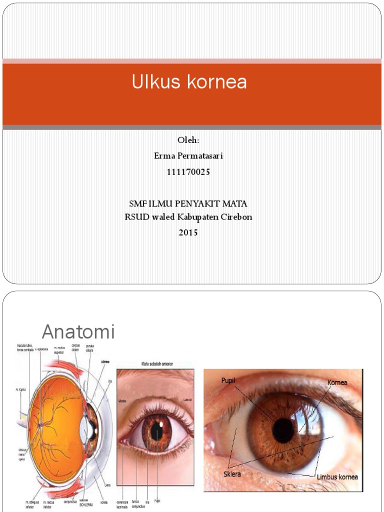 Ulkus Kornea | PDF