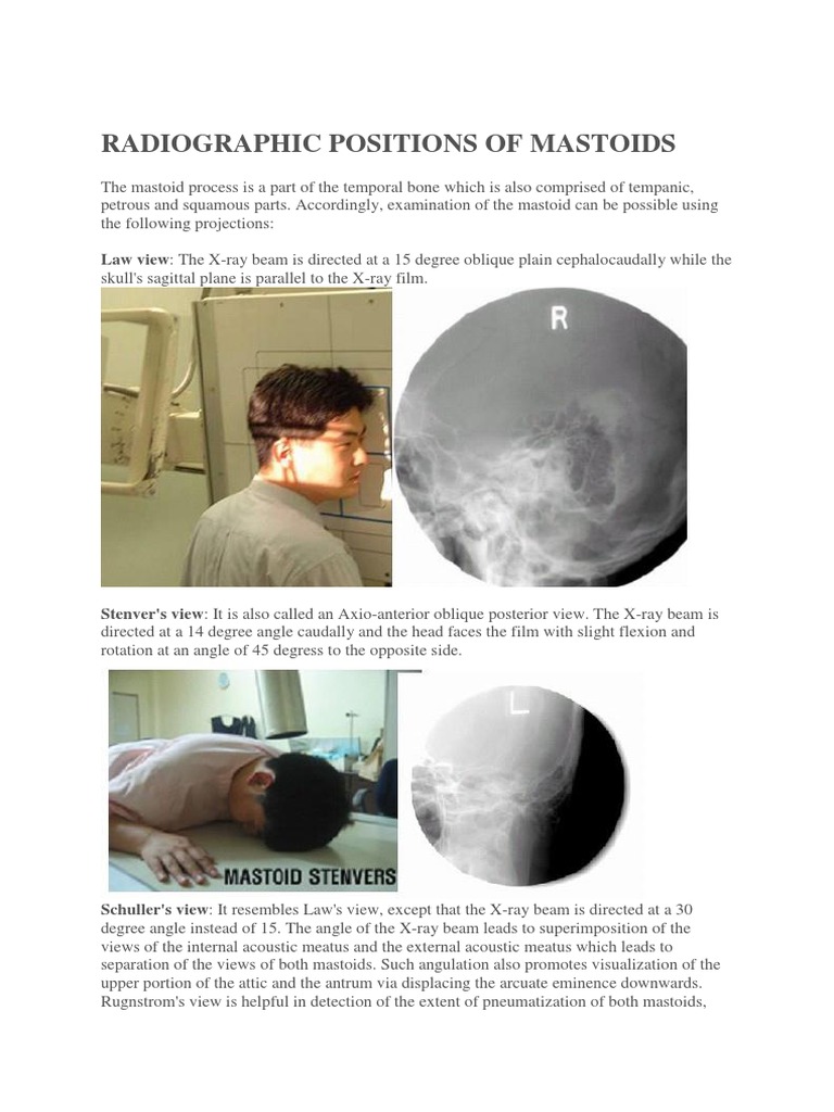 Radiographic Positions of Mastoids | PDF | Human Head And Neck | Human ...