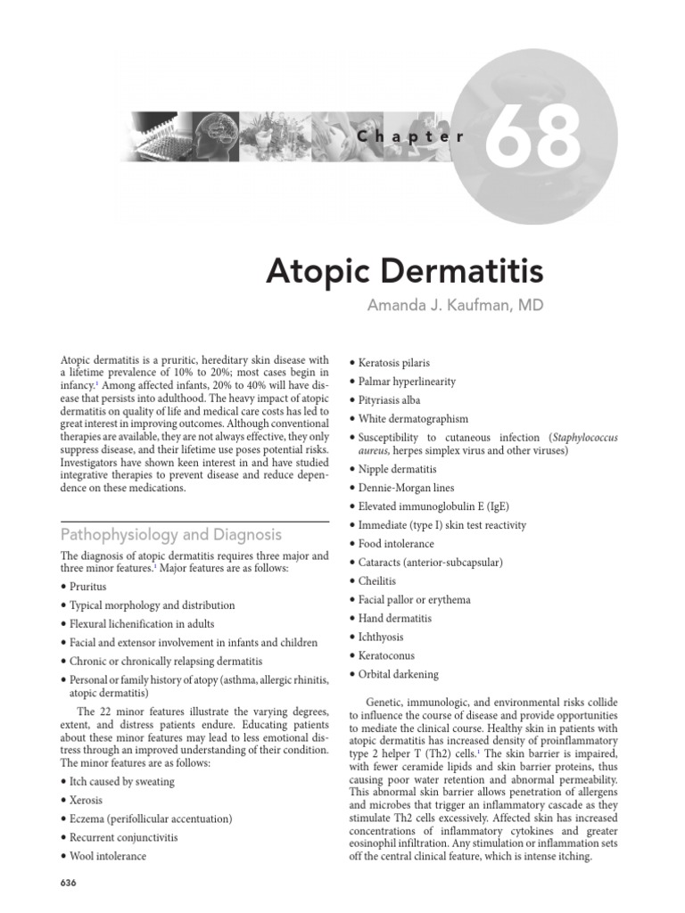 Atopic Dermatitis | Dermatitis | Allergy