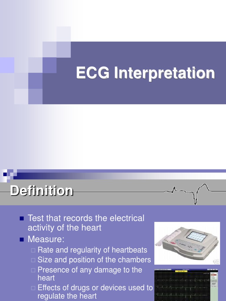 ECG Tutorial | PDF | Electrocardiography | Heart