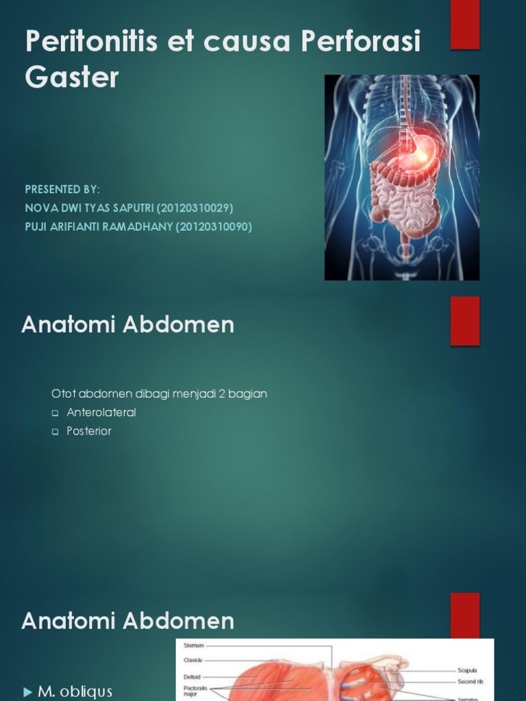 Peritonitis Et Causa Perforasi Gaster | PDF