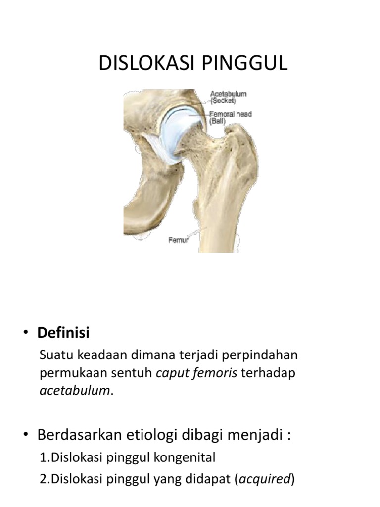 Dislokasi Pinggul | PDF