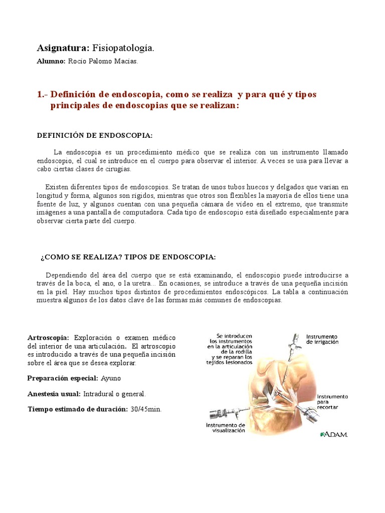 Endoscopias y Tipos de Endoscopias | Endoscopia | Biopsia