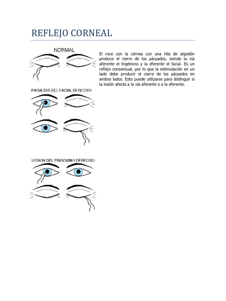 Reflejo Corneal PDF | PDF