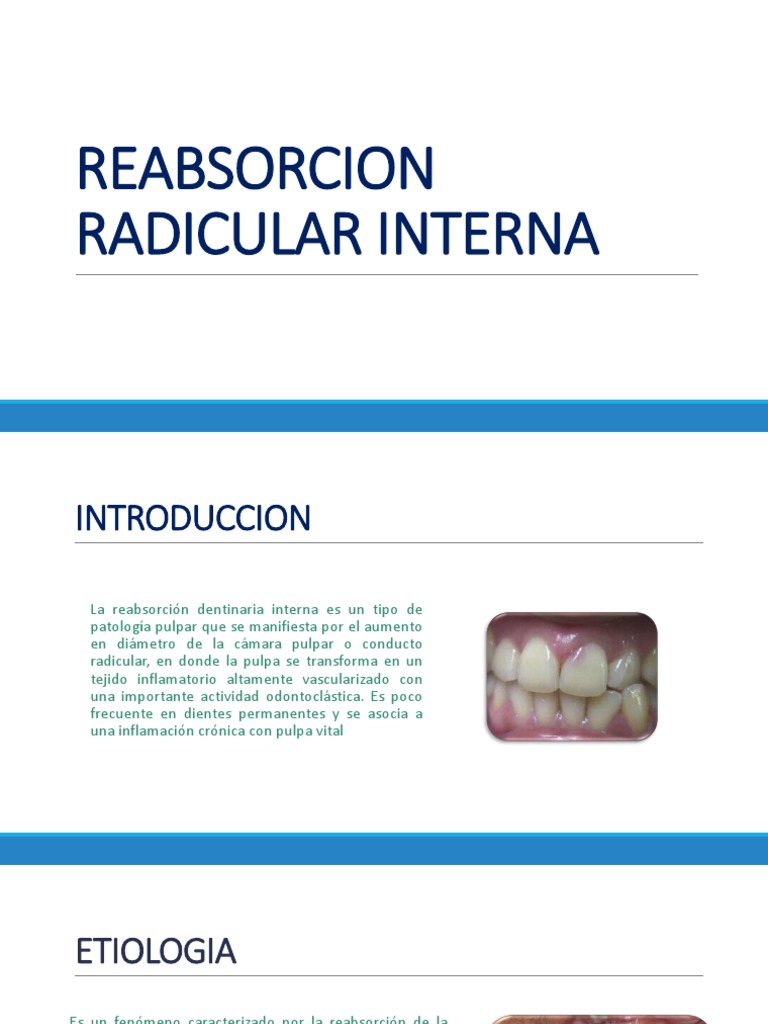 Reabsorcion Radicular Interna | PDF | Inflamación | Ciencias de la Salud