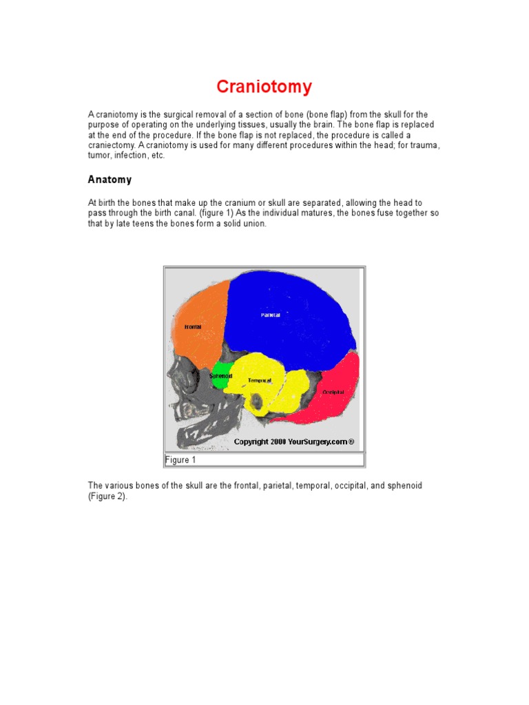Craniotomy | Brain Tumor | Skull