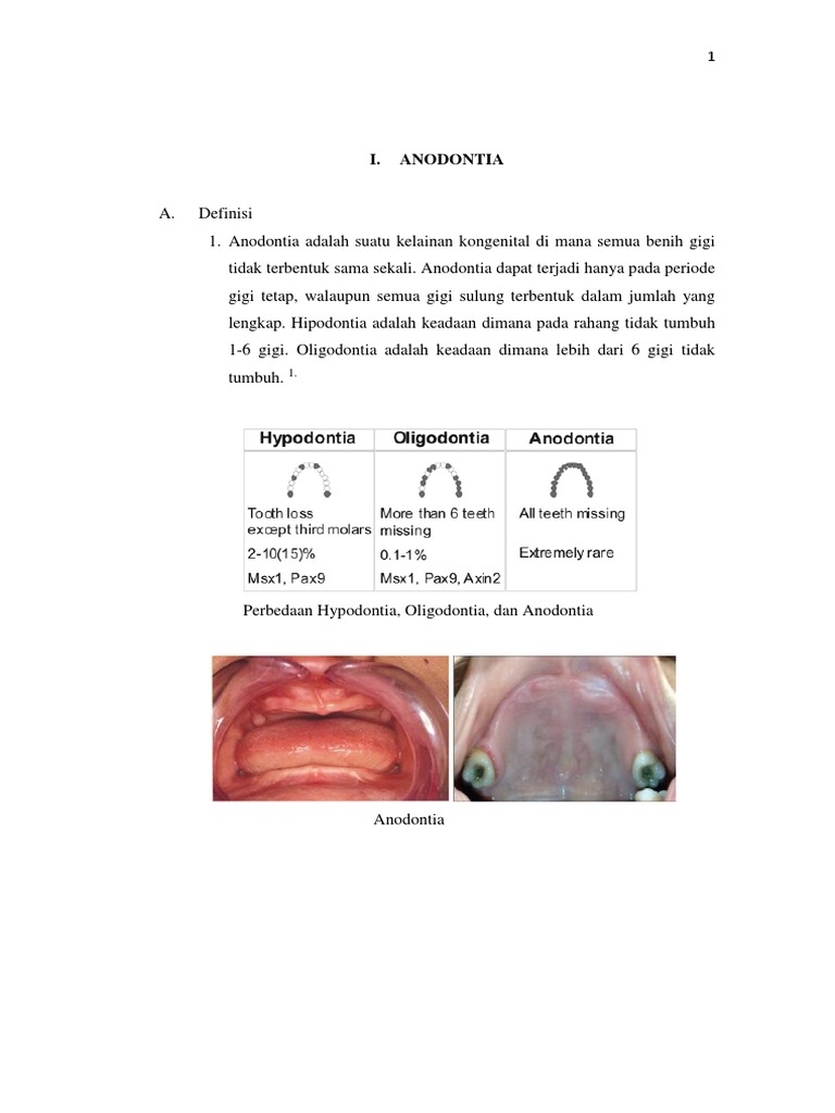 Penyakit Gigi Dan Mulut | PDF | Kesehatan Holistik