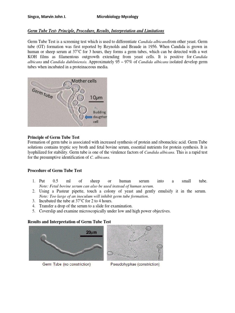 Germ Tube Test | Yeast | Microorganism