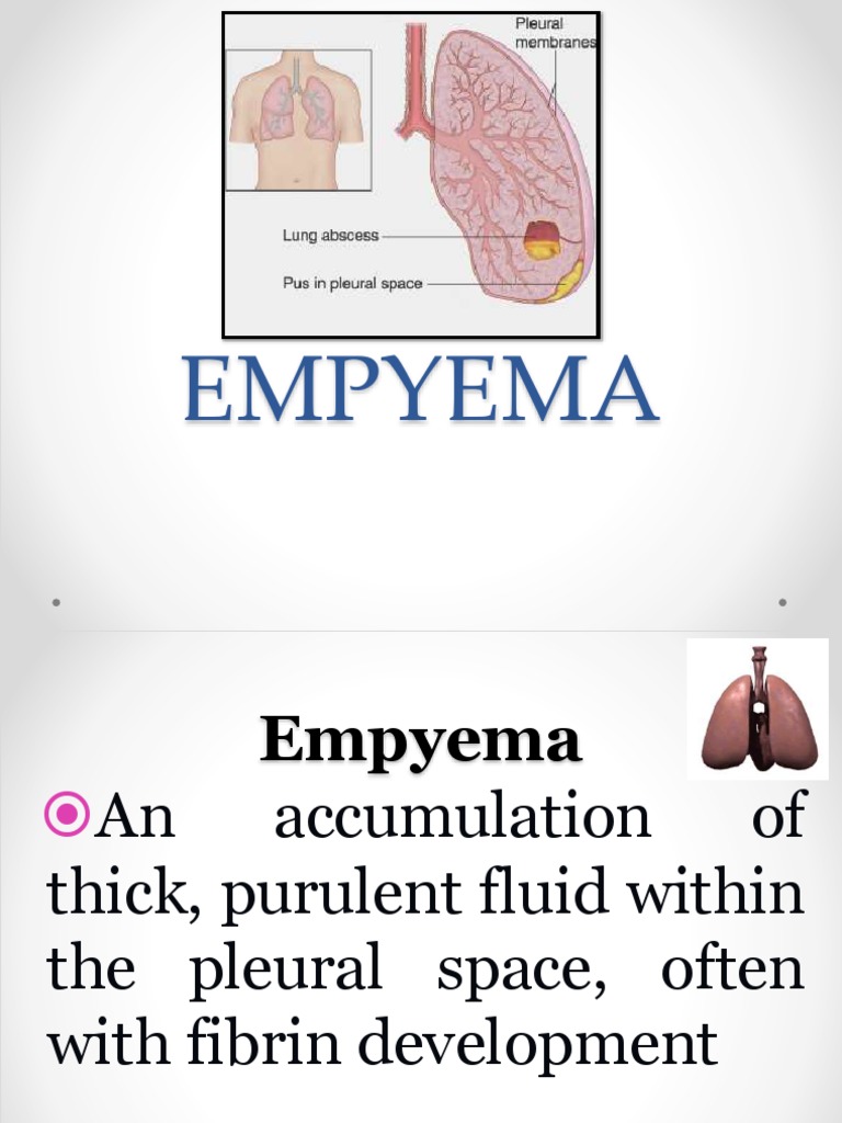 Empyema 171013100219 | PDF | Medical Specialties | Health Sciences