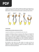 Síndrome de Potter | PDF | Epidemiología | Medicina