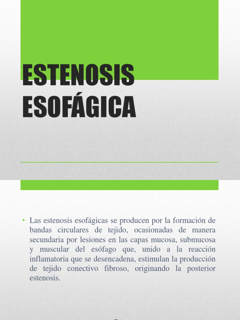 Estenosis esofágica: causas, síntomas, diagnóstico y tratamiento | PDF ...