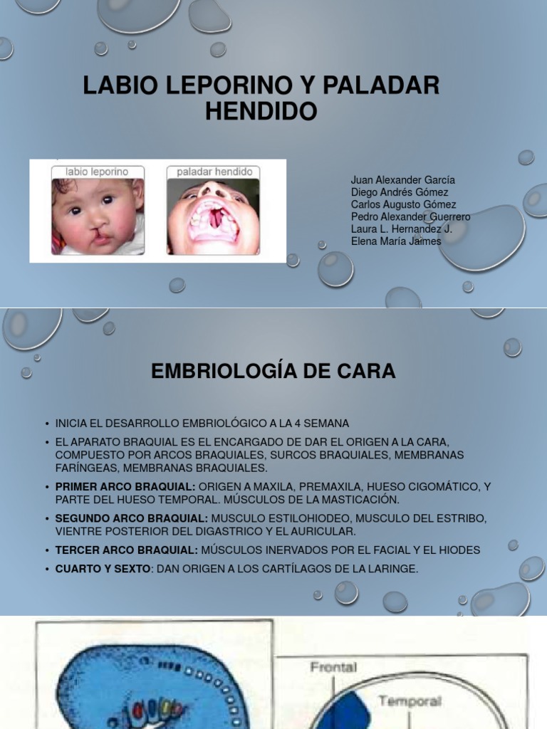 Labio Leporino y Paladar Hendido: Guía Completa | PDF | Anatomía humana ...