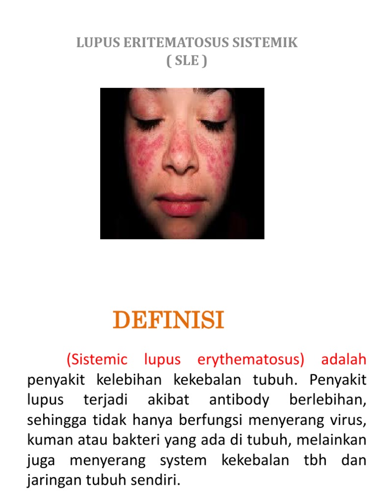 Askep Sle | PDF | Kesehatan Holistik