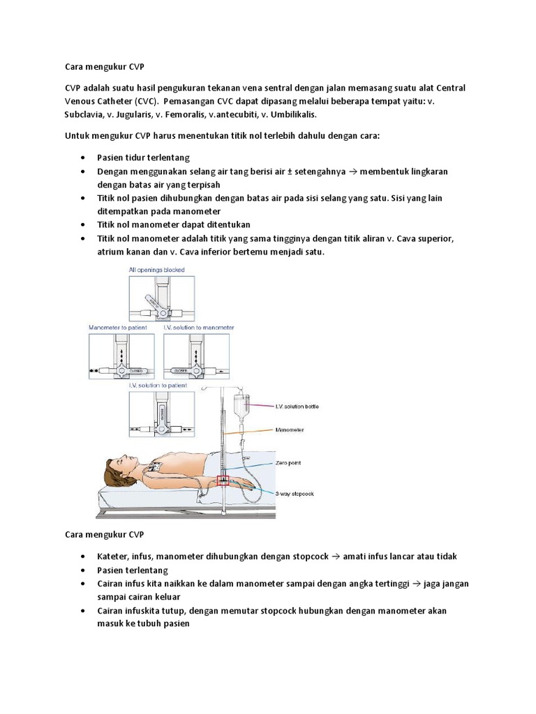 Cara Mengukur CVP | PDF | Sains & Matematika