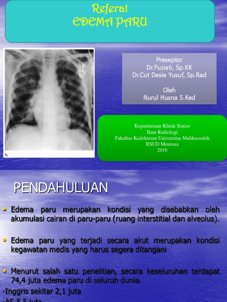 Edema Paru | PDF