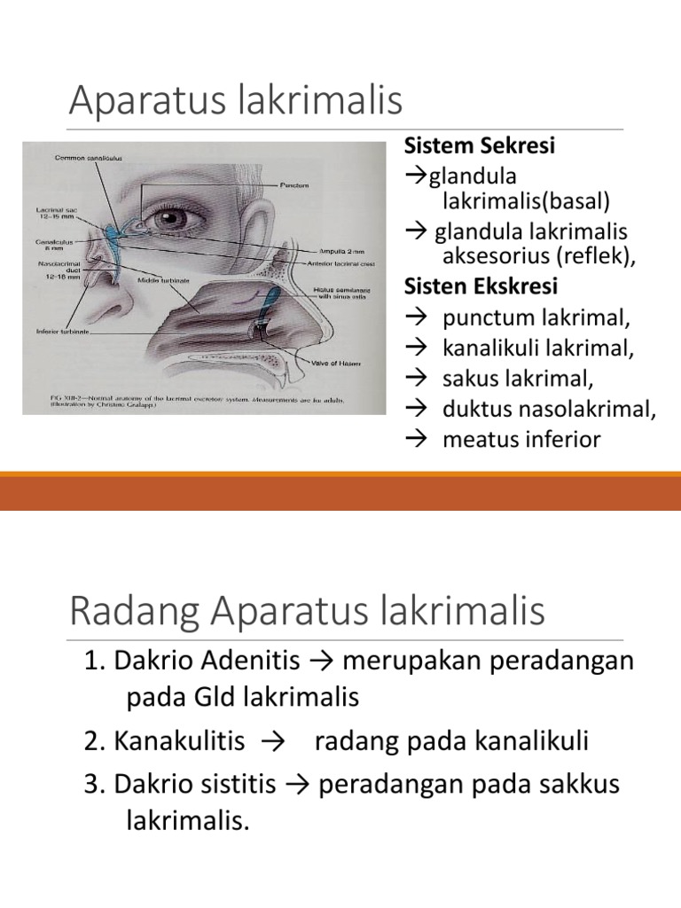 Dakriosistitis Dan Dakrioadenitis | PDF | Sains & Matematika