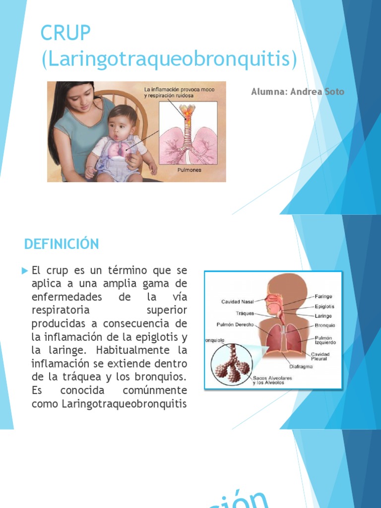 CRUP (Laringotraqueobronquitis) | Enfermedades respiratorias | Medicina ...