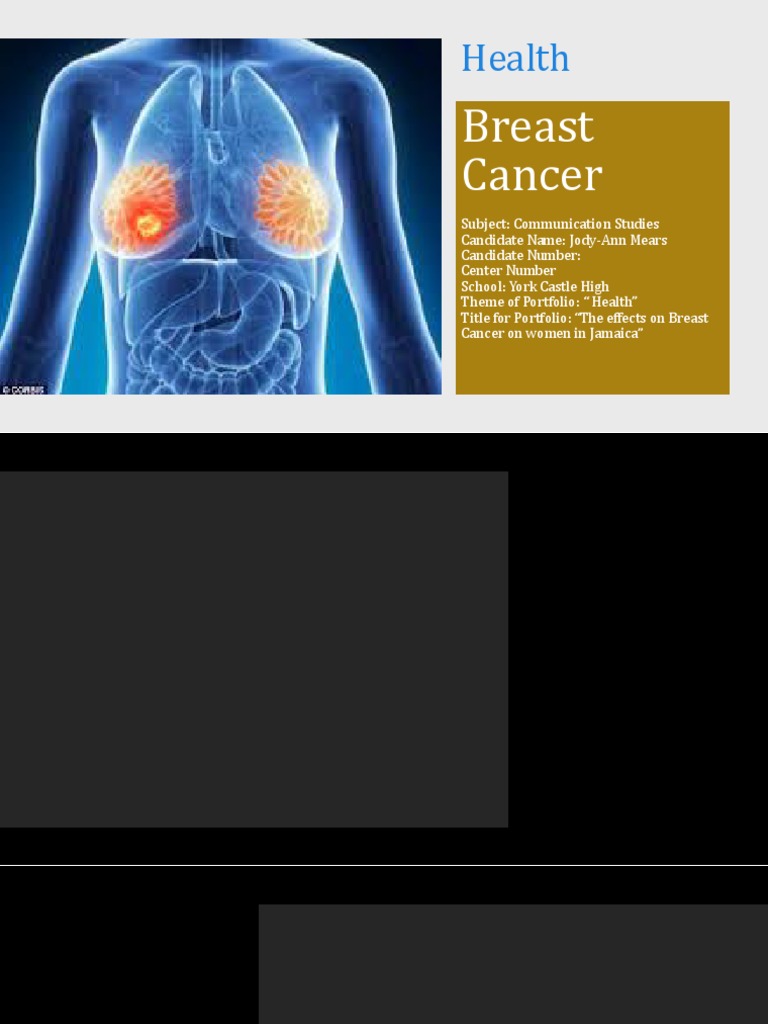 Breast Cancer | PDF