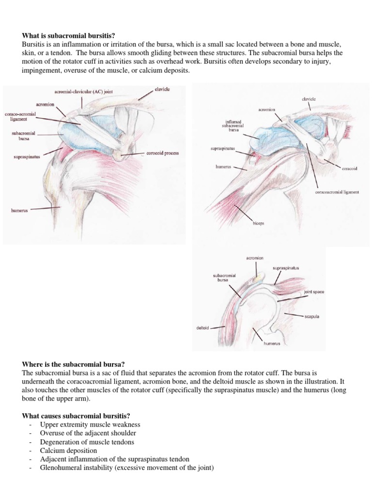 Subacromial Bursitis Patients | PDF | Limbs (Anatomy) | Human Anatomy