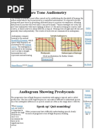 Pure Tone Average Calculation Methods | PDF | Classical Mechanics ...