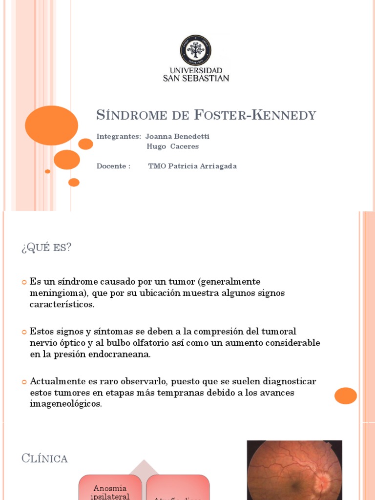 Síndrome de Foster Kennedy | PDF | Rtt | Ciencias de la Salud