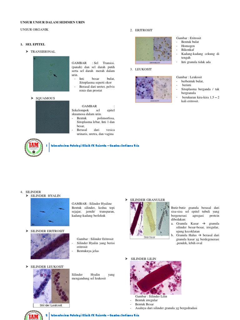 Analisis Sedimen Urin dan Silinder | PDF