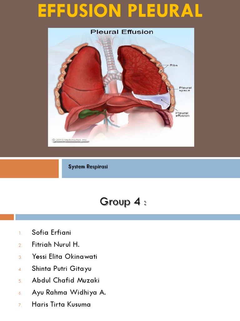 Efusi Pleura PPT - Id.en (Repaired) | PDF | Clinical Medicine | Medicine